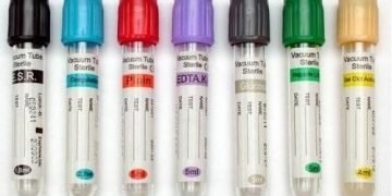 Many of us are familiar with the sight of blood collection tubes ...